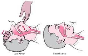 BASIC LIFE SUPPORT - Vic First Aid