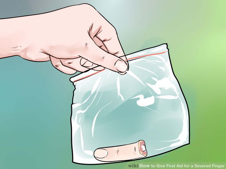 TRAUMA - BLEEDING AND WOUND MANAGEMENT - Vic First Aid